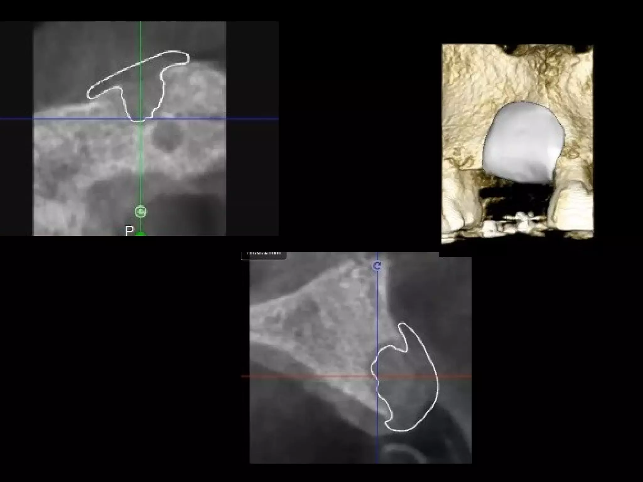 Basic applications of CBCT | PPT
