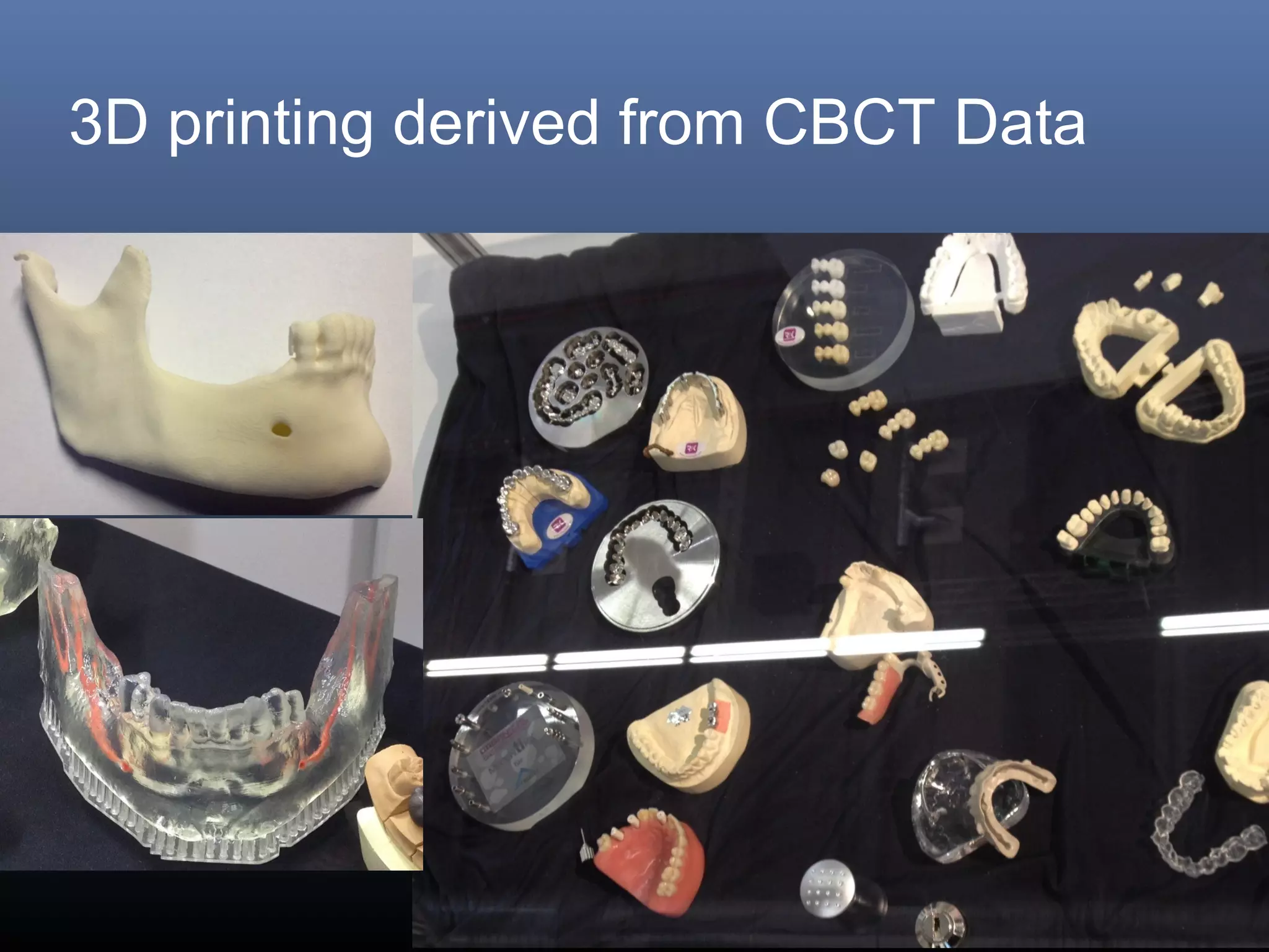 Basic applications of CBCT | PPT