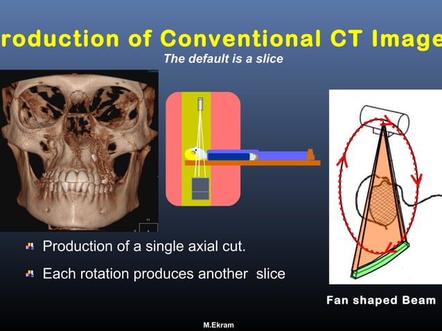 Basic applications of CBCT | PPT | 3-D Graphics | Computer Software and ...