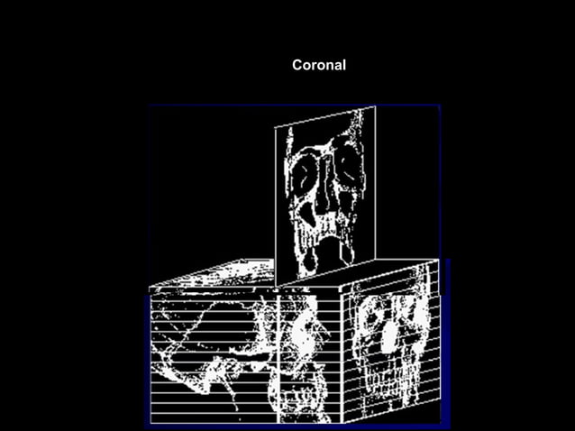 Basic applications of CBCT | PPT | 3-D Graphics | Computer Software and ...