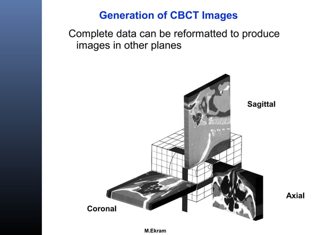 Basic applications of CBCT | PPT | 3-D Graphics | Computer Software and ...