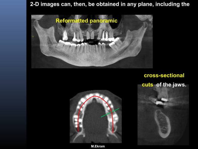 Basic applications of CBCT | PPT | 3-D Graphics | Computer Software and ...
