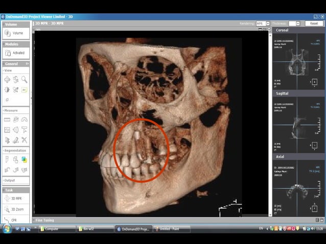 Basic applications of CBCT | PPT | 3-D Graphics | Computer Software and ...