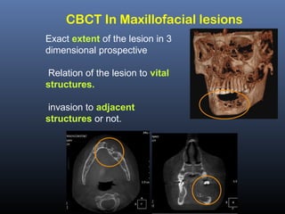 Basic applications of CBCT | PPT