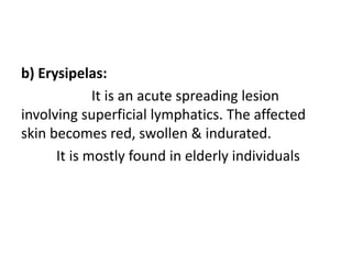 2. streptococcus | PPTX