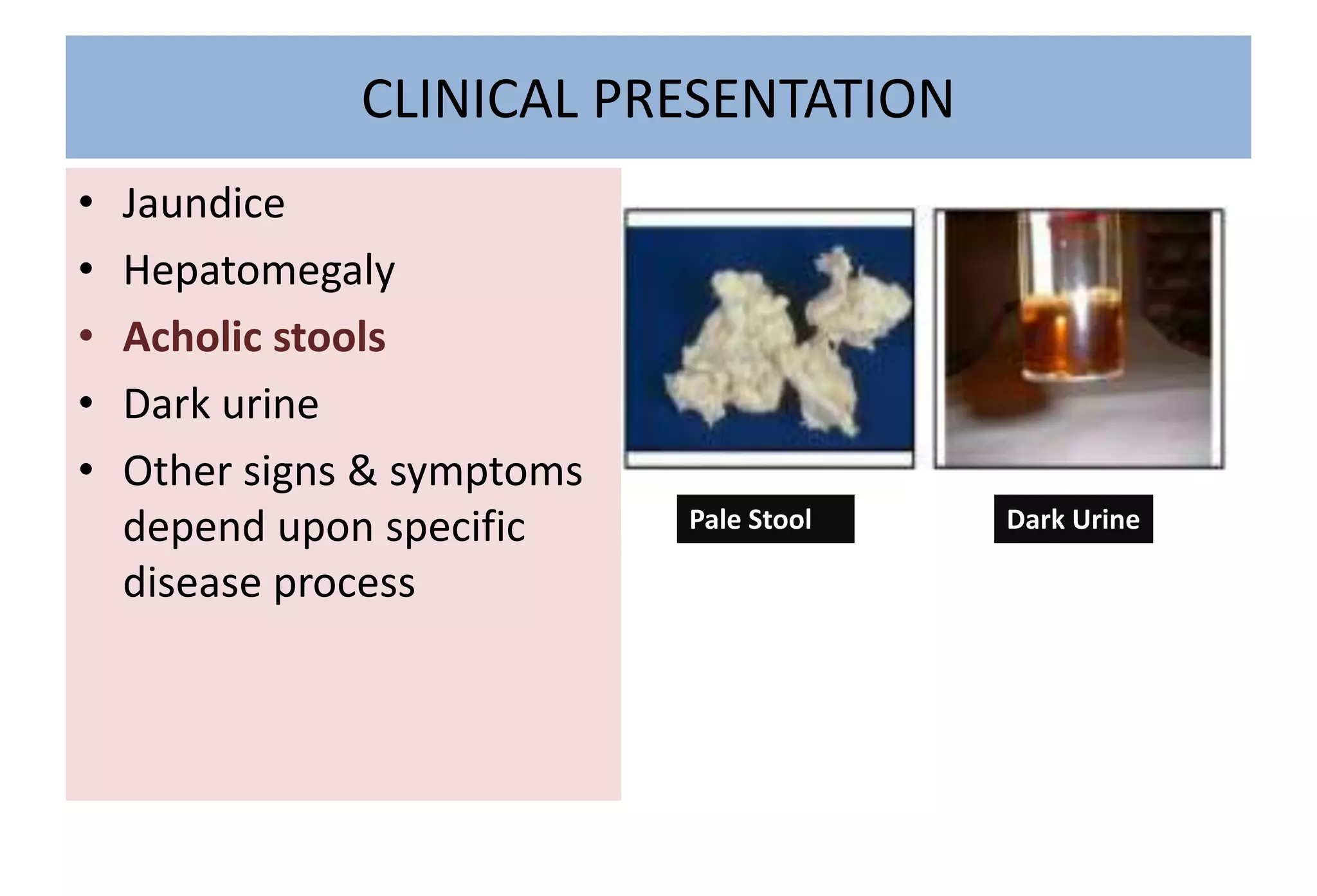 Neonatal Cholestasis | PPTX