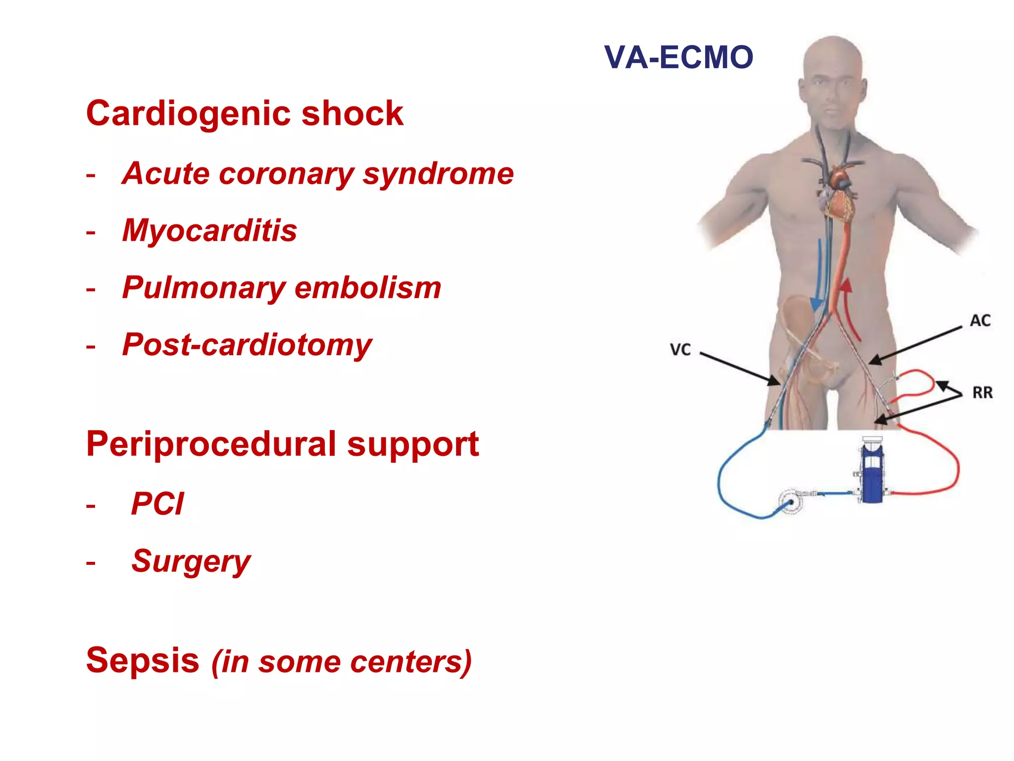 2. ecmo indications #beach2019 (bouchez) | PPTX