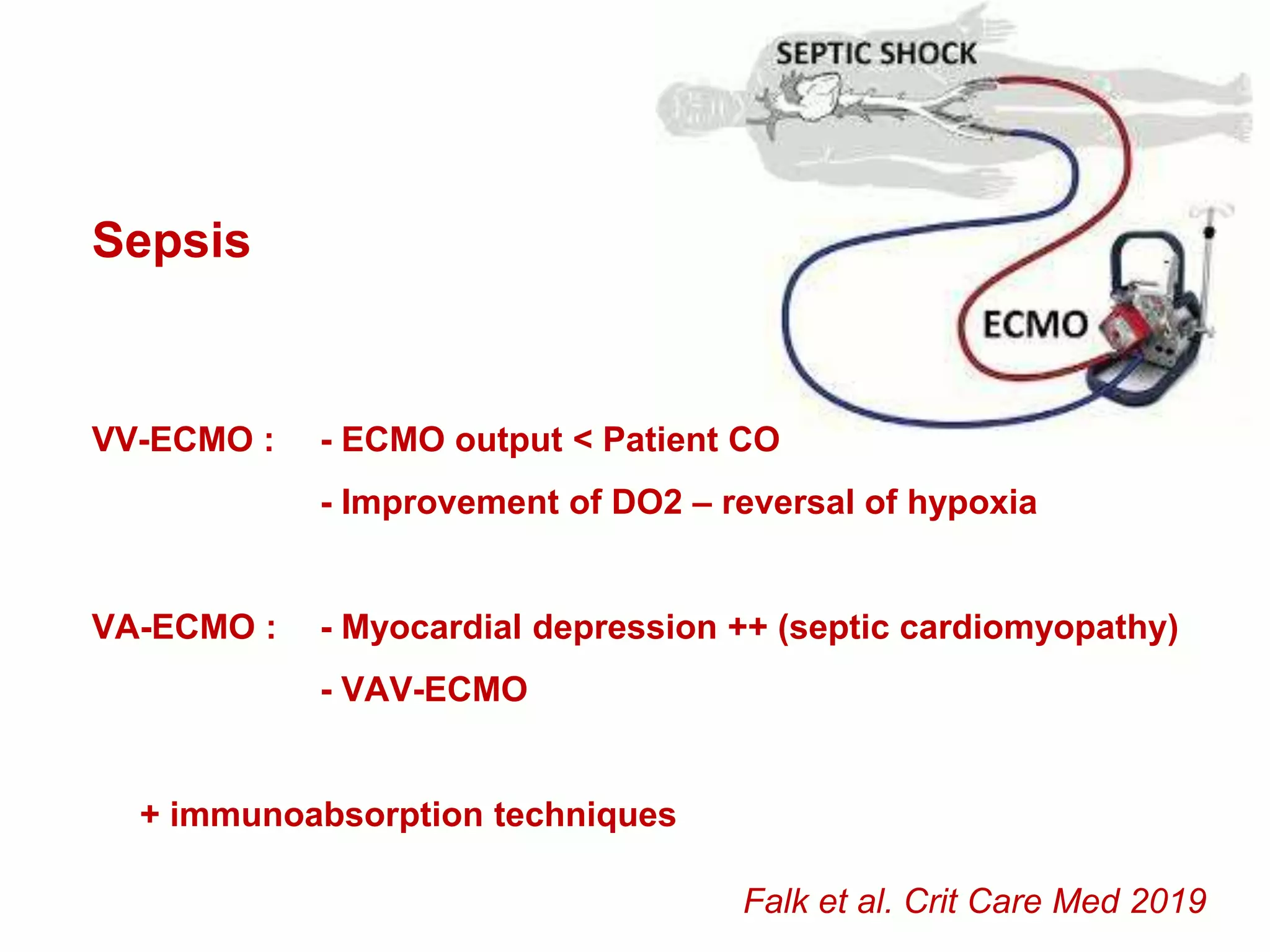 2. ecmo indications #beach2019 (bouchez) | PPTX