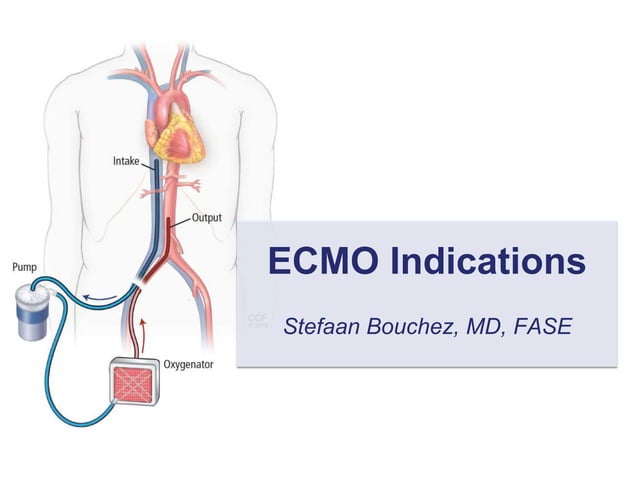 2. ecmo indications #beach2019 (bouchez) | PPT
