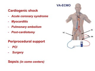 2. ecmo indications #beach2019 (bouchez) | PPTX
