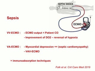 2. ecmo indications #beach2019 (bouchez) | PPTX