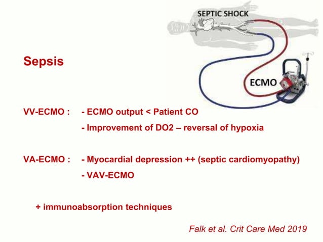 2. ecmo indications #beach2019 (bouchez) | PPT