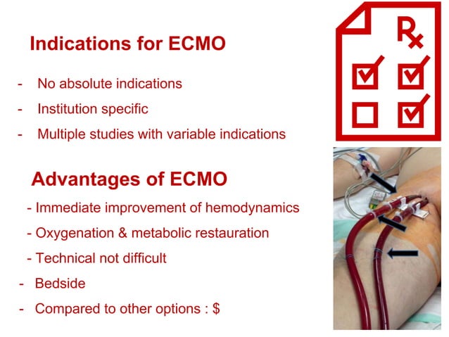 2. ecmo indications #beach2019 (bouchez) | PPT