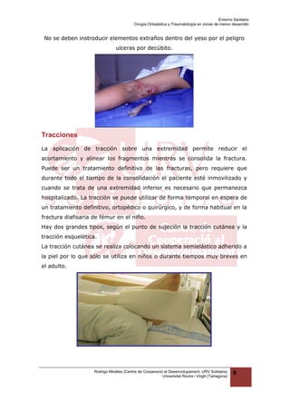 2.5. tecnicas de_tratamiento_de_las_fracturas | PDF