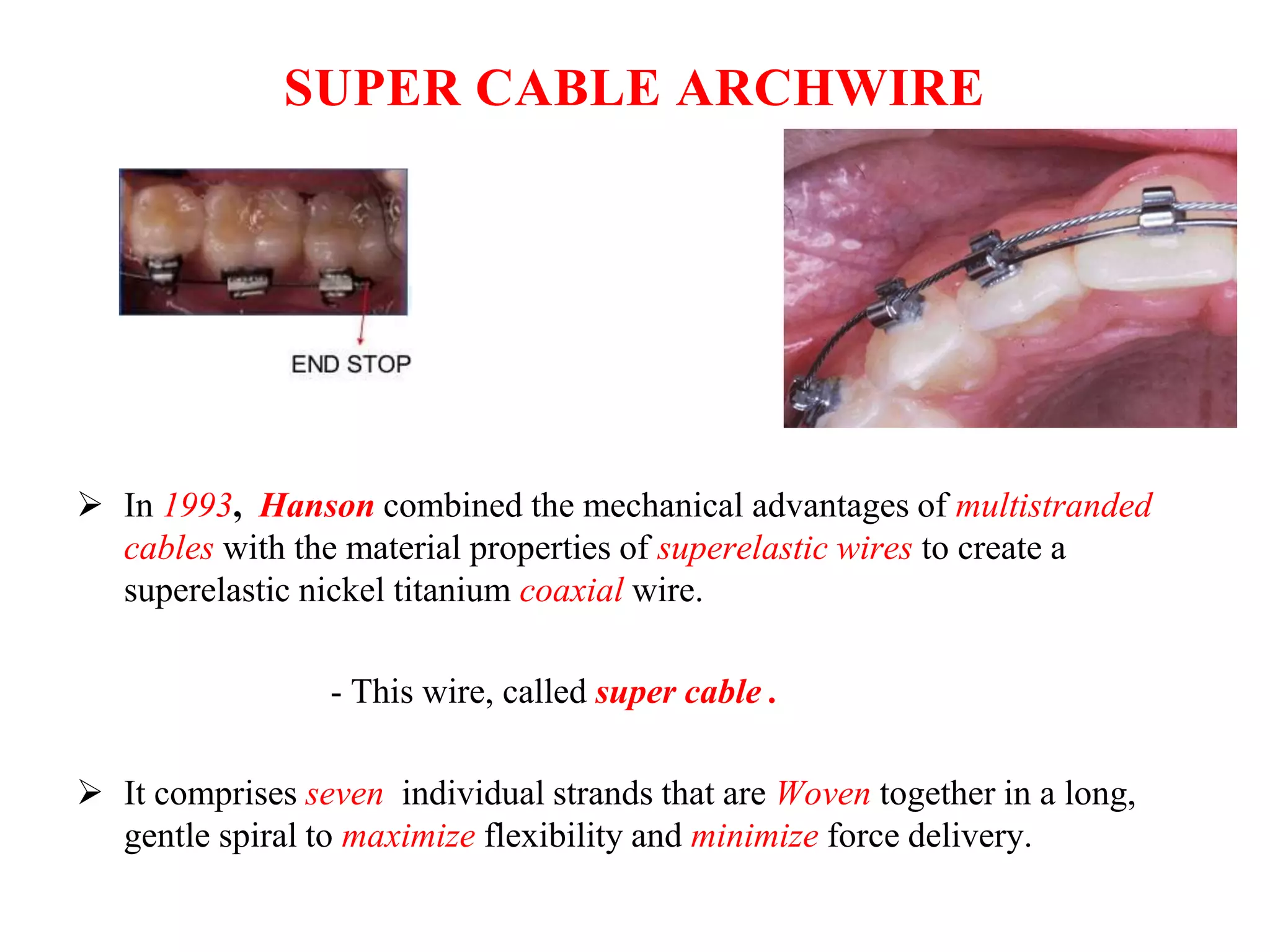 Recent advances in Orthodontic archwires | PPT | Oral care | Personal Care