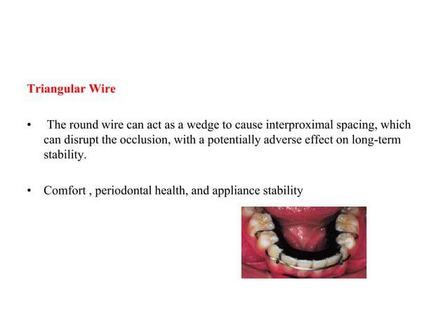 Recent advances in Orthodontic archwires | PPT | Oral care | Personal Care
