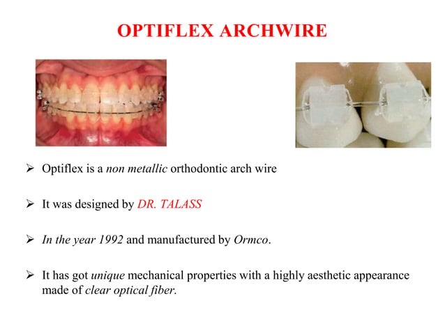 Recent advances in Orthodontic archwires | PPT | Oral care | Personal Care