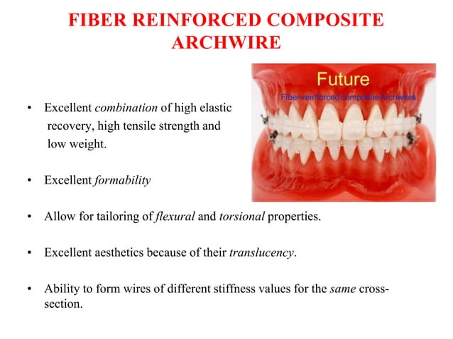 Recent advances in Orthodontic archwires | PPT | Oral care | Personal Care