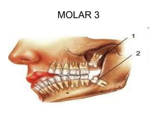 2. dental anatomi gigi permanen .. | PPT