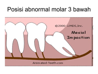 2. dental anatomi gigi permanen .. | PPT