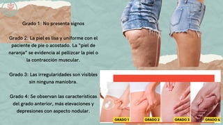 CELULITIS. Cavitacion y Yesoterapia | PDF