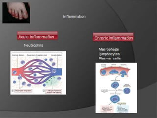 2.Chronic Inflammation | PPT
