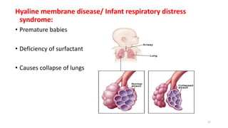 Mechanics of Respiration | PPSX