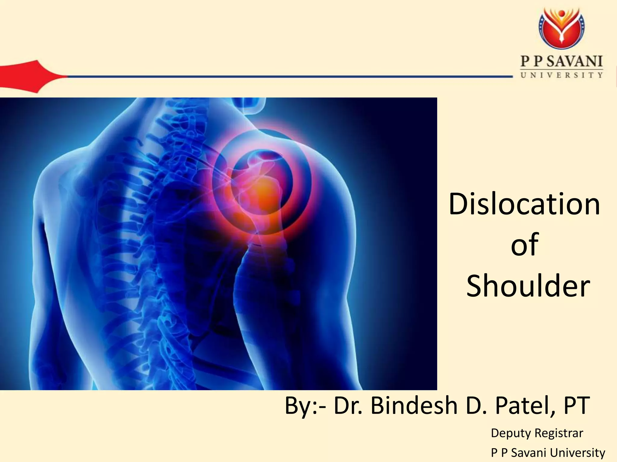 2. Dislocation of Shoulder | PPTX