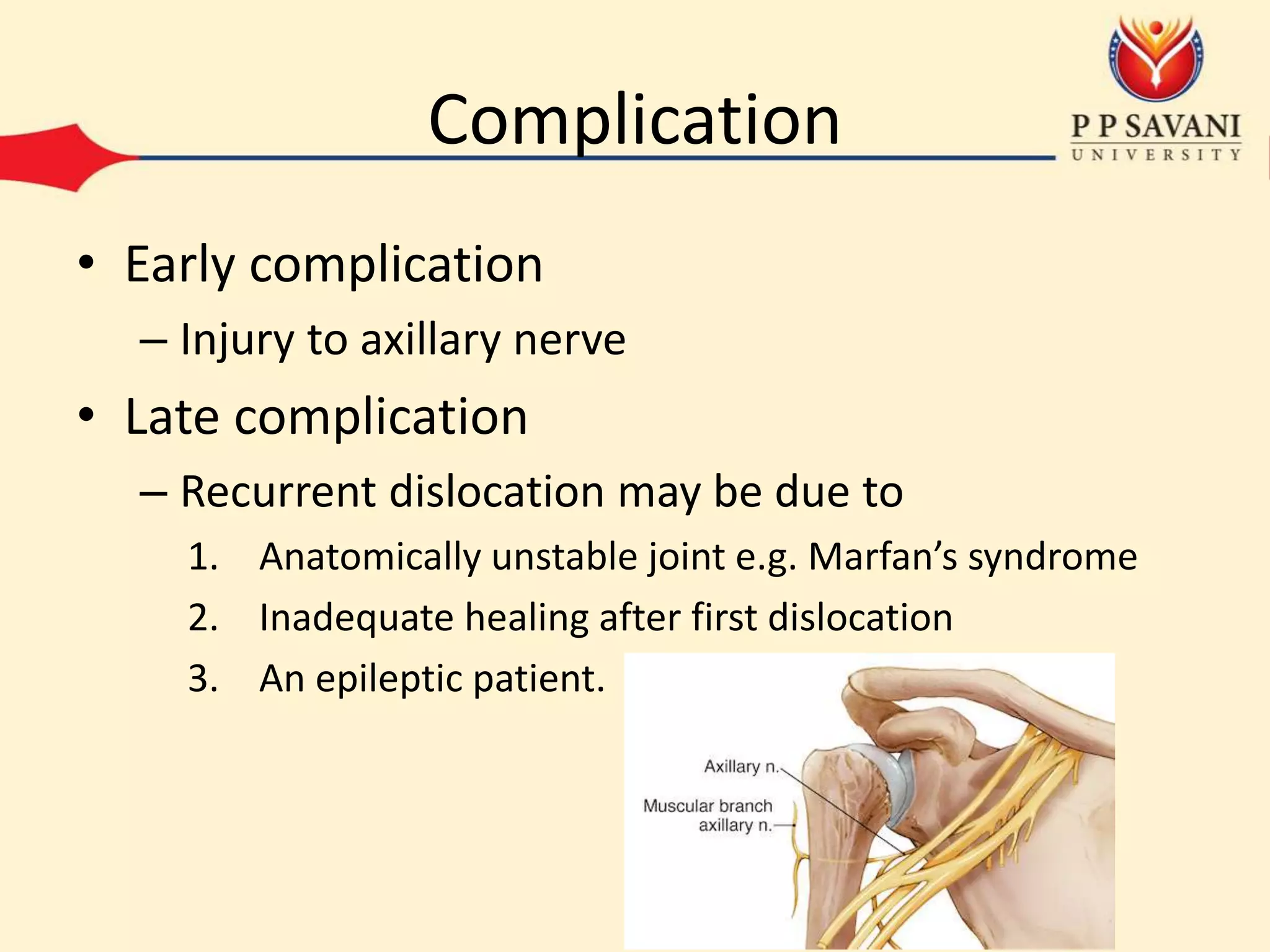 2. Dislocation of Shoulder | PPTX