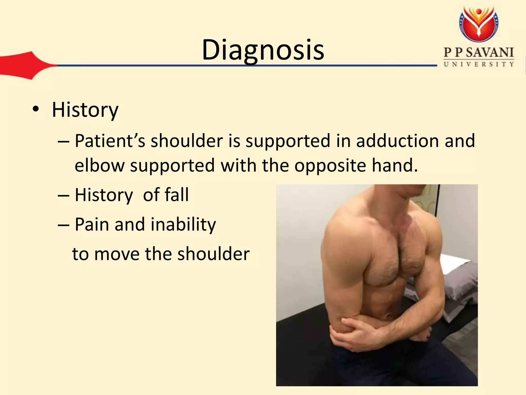 2. Dislocation of Shoulder | PPTX