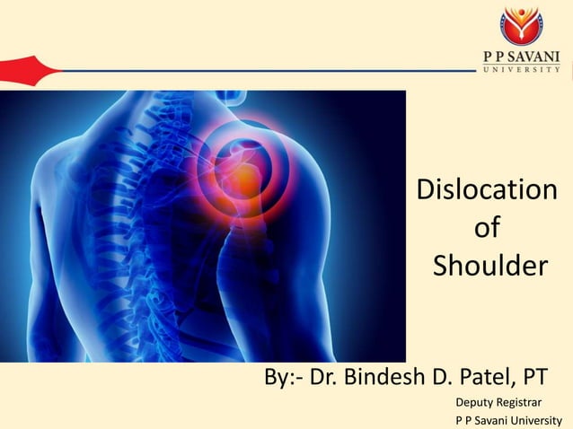 2. Dislocation of Shoulder | PPTX