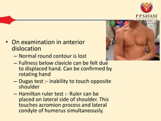 2. Dislocation of Shoulder | PPTX