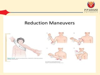 2. Dislocation of Shoulder | PPTX