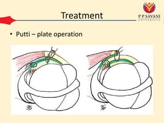 2. Dislocation of Shoulder | PPTX