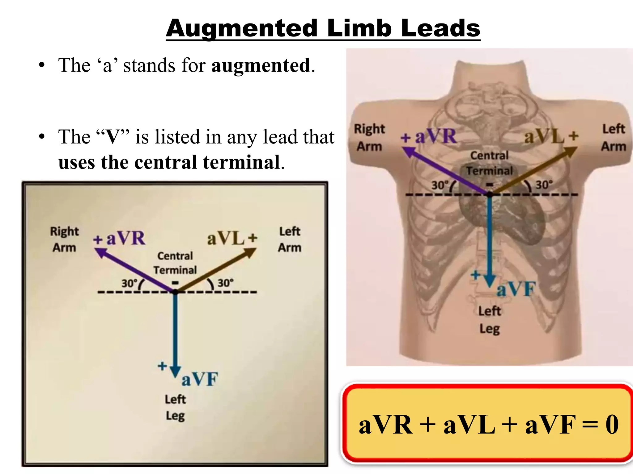 2. ecg basics leads | PPT