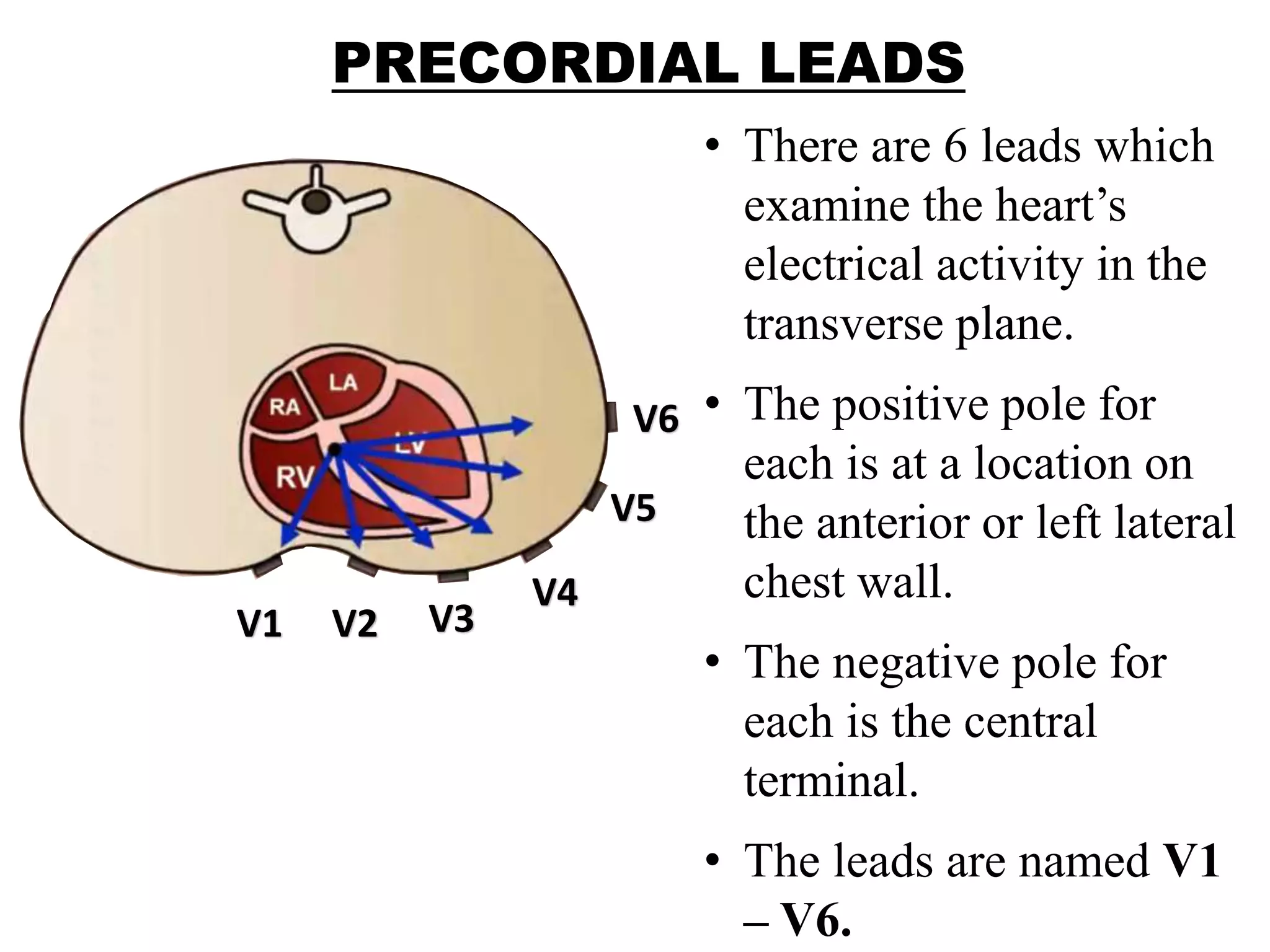 2. ecg basics leads | PPT