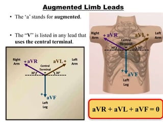 2. ecg basics leads | PPT