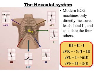 2. ecg basics leads | PPT