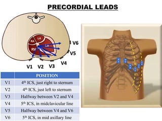 2. ecg basics leads | PPTX