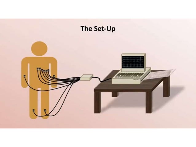 2. ecg basics leads | PPT