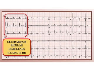 2. ecg basics leads | PPTX