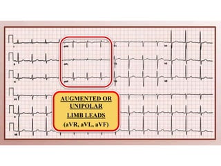 2. ecg basics leads | PPT