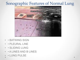 pneumothorax | PPTX | Lung and Respiratory Health | Diseases and Conditions