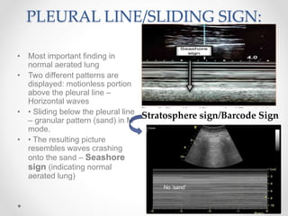 pneumothorax | PPTX | Lung and Respiratory Health | Diseases and Conditions