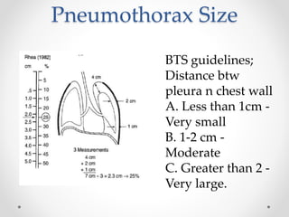 pneumothorax | PPTX