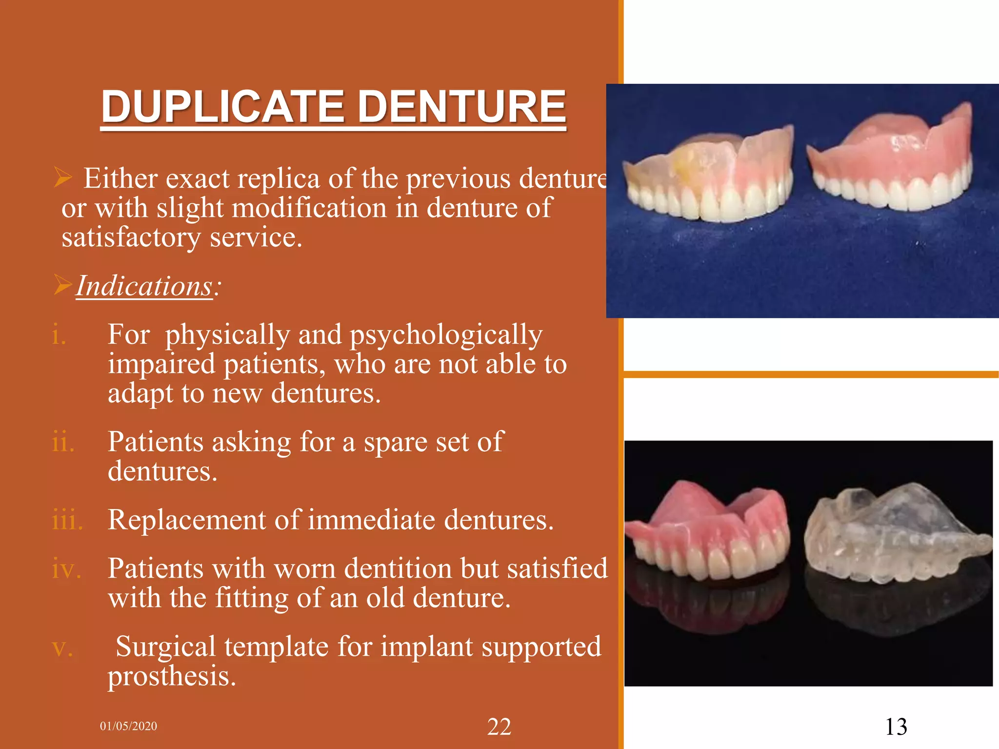 special/ unconventional dentures | PPTX