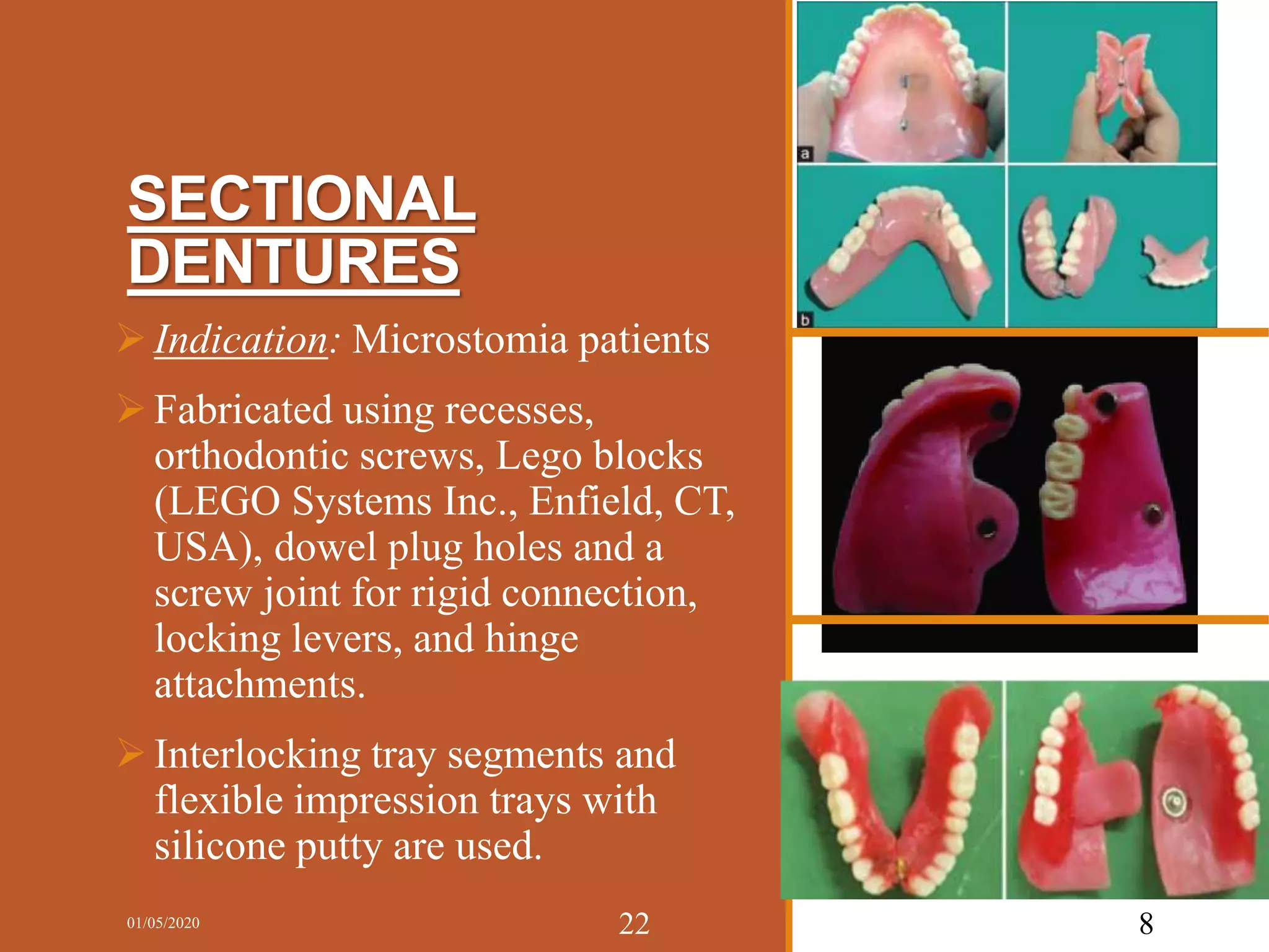 special/ unconventional dentures | PPTX