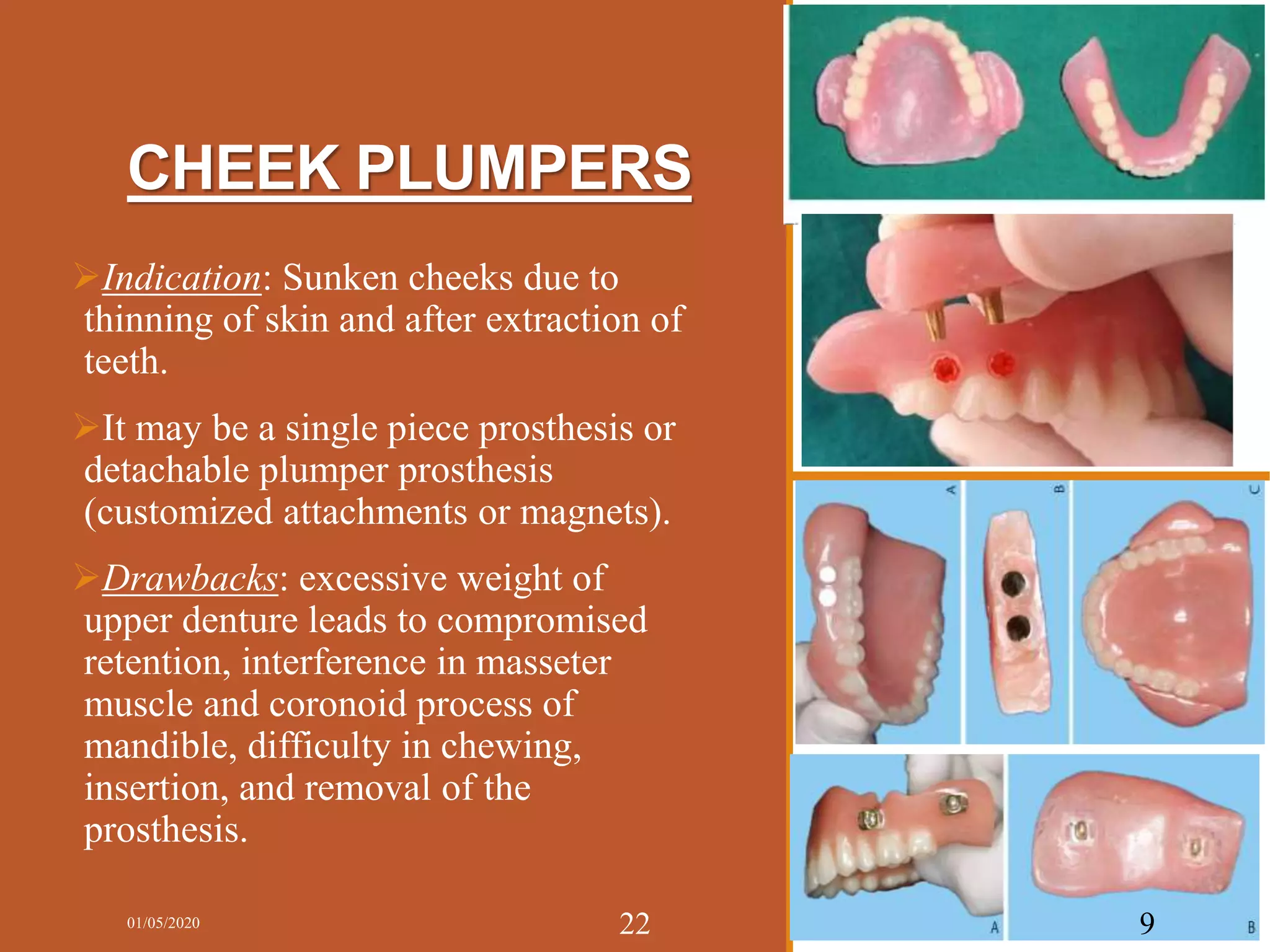 special/ unconventional dentures | PPTX