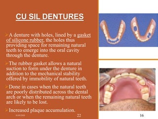special/ unconventional dentures | PPTX