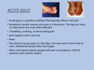 Gout - types,causes,treatment | PPT